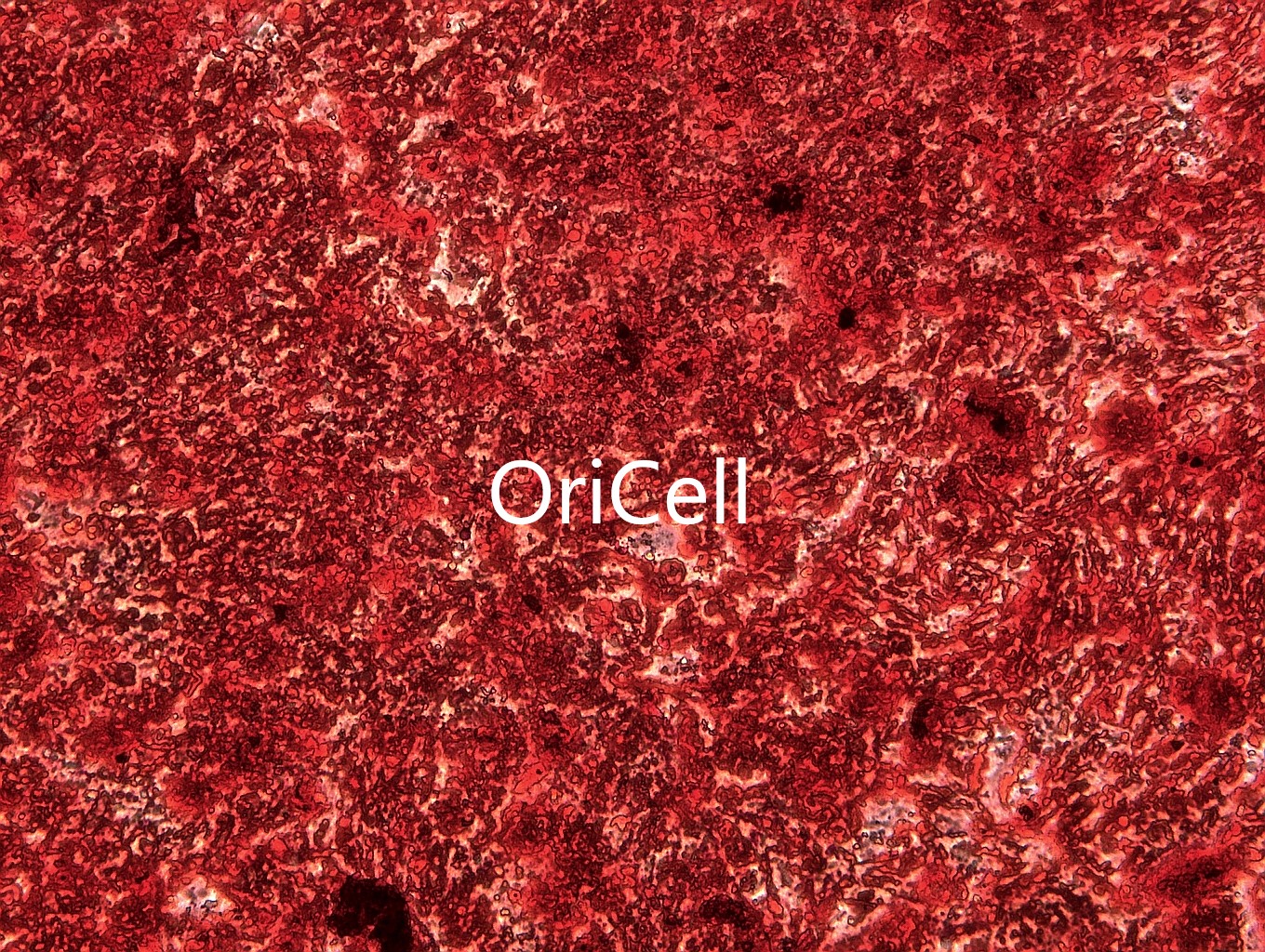 How to Achieve Stunning Alizarin Red S Staining in Osteogenic ...